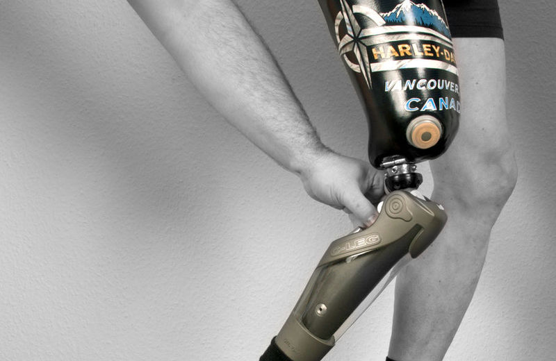 Individuelle Prothesen